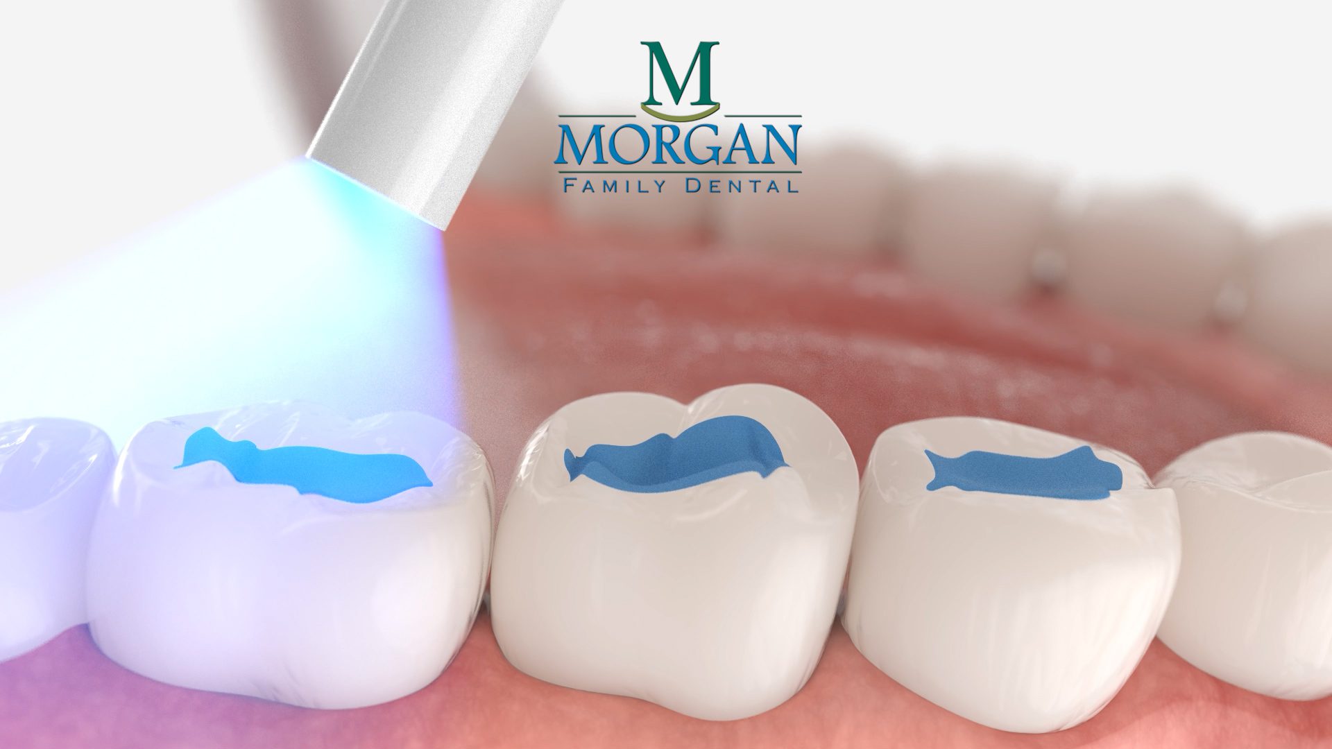 Metairie Dentist: Dr. Ken Morgan DDS | Morgan Family Dental Metairie Dentist: Dr. Ken Morgan DDS | Morgan Family Dental